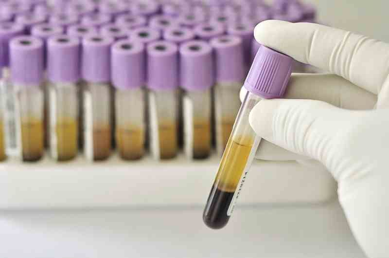 Ematocrito basso: cosa significa, cosa comporta | retehphitalia.it blog ...